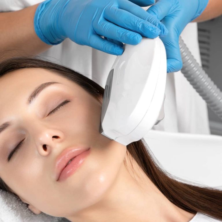 The Superiority of Dye-VL: An Advanced IPL Treatment