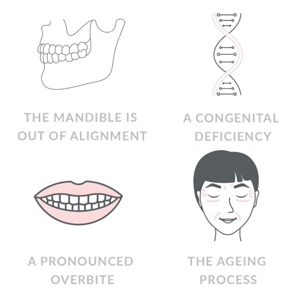 Understanding Chin Implants: Modern Plastic Surgery