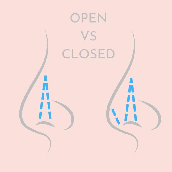 What Makes The Preservation Rhinoplasty So Special?