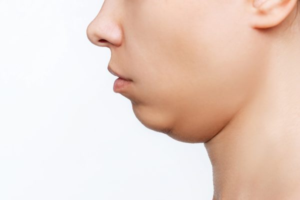 Find Which Jaw Reshaping Procedure Is Right For You