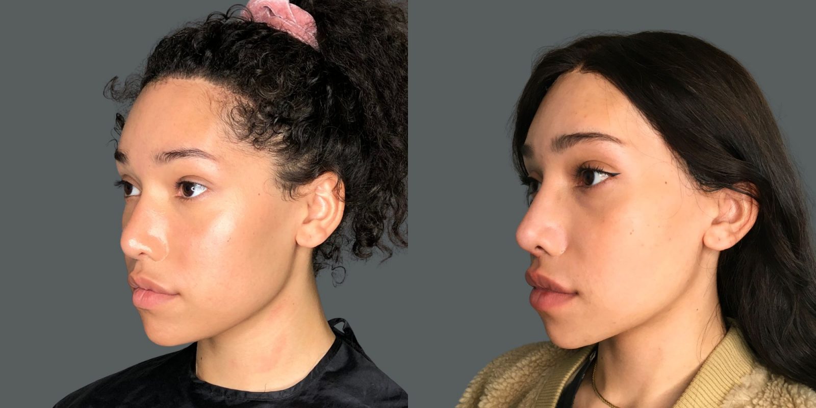 Bespoke Jaw Reshaping Procedures from 111 Harley St.