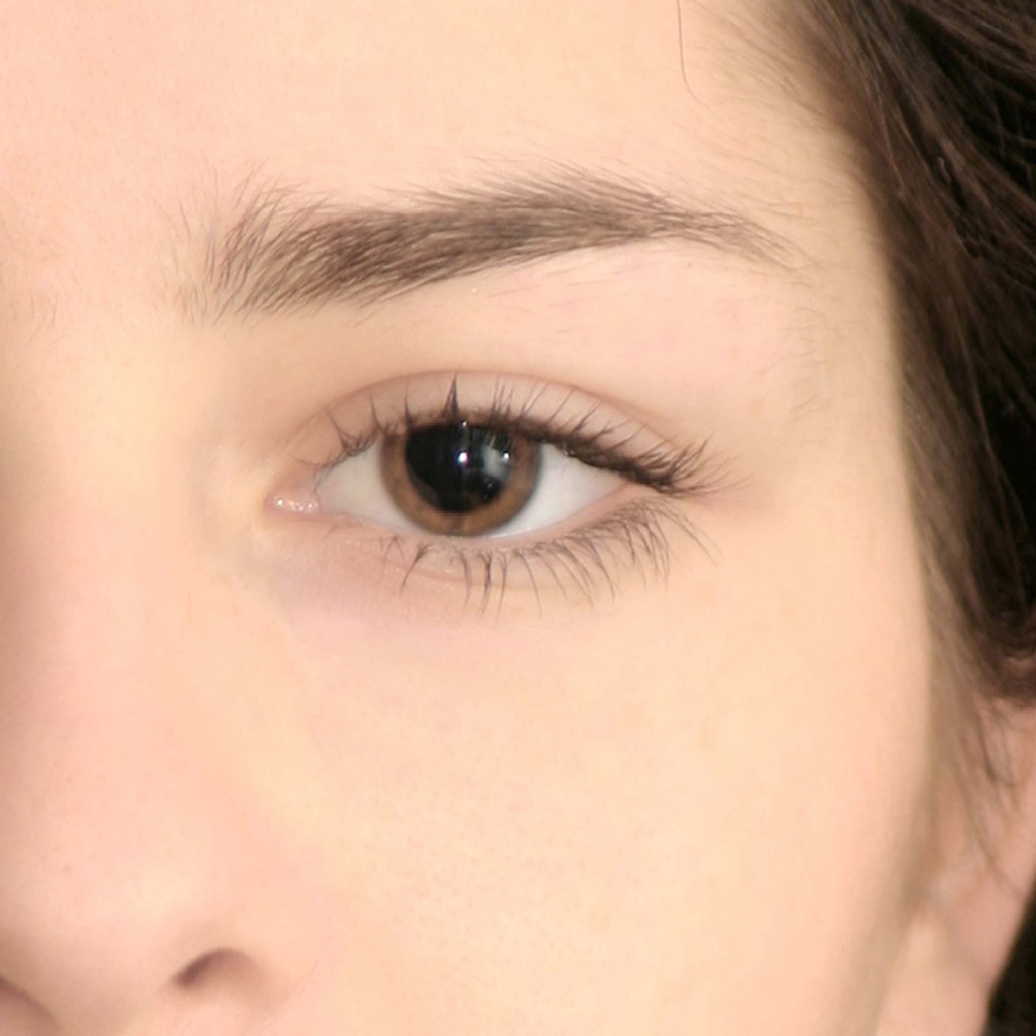 The Allure of The Eyes & Surgeries To Improve Them