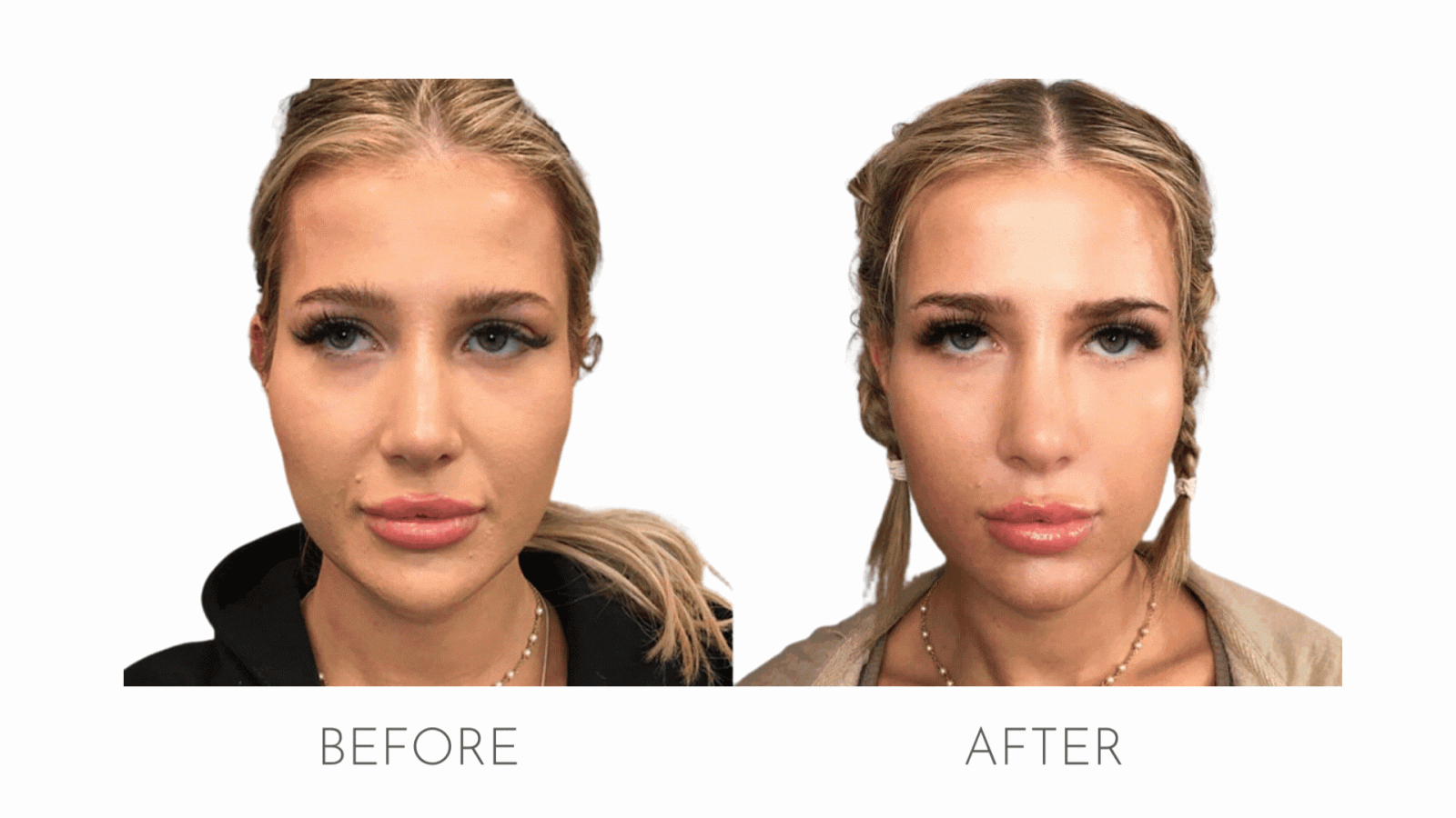 Top 3 Effective Ways to Define Your Jawline Today